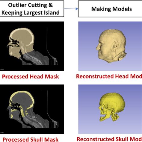 Segmentation And Surface Reconstruction Of The Head And Skull From Ct