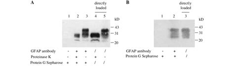 Detection Of Prp Sc Gfap And Prp C Gfap Complexes In Hamsters Brain Download Scientific