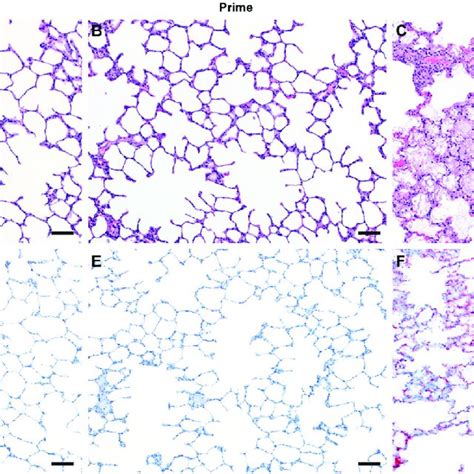 Pulmonary Effects Of Chadox1 Niv Vaccine Efficacy In The Agm Model Of Pulmonary Effects Of Chadox1 Niv Vaccine Efficacy In The Agm Model Of