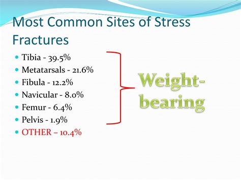 PPT Stress Fractures PowerPoint Presentation ID