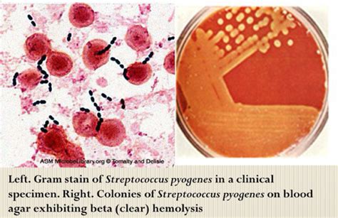 Immun Chapter 14 Strep Flashcards Quizlet