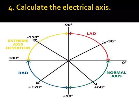 Basic Ecg Readingspptx