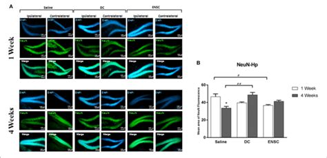 Expression Of Mature Neurons NeuN A Microscopic Images For NeuN Download Scientific