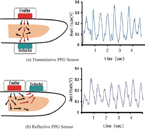 Figure 4 From Motion Artifacts Reduction From Ppg Using Cyclic Moving Average Filter Semantic