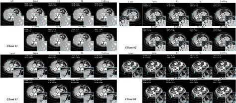 Figure 5 From Dynamic Corrected Split Federated Learning With