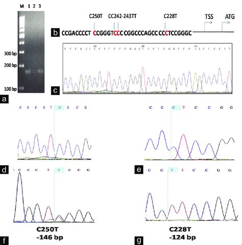 A Pcr Amplified Products Of Tert Promoter From Conjunctival Scc Cases Download Scientific