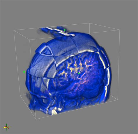 New Example Deform A Volume With A Thin Plate Spline Algorithms Itk