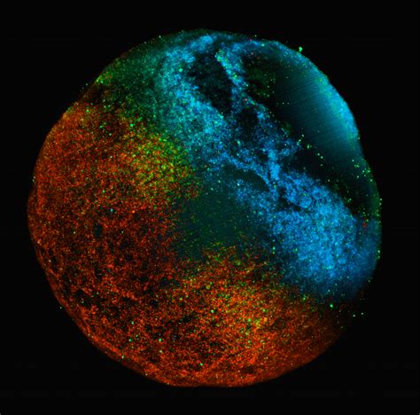 Single Plane Illumination Microscopy Spim Light Sheet Archives Focalplane