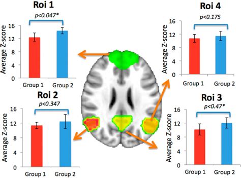 Resting State Default Mode Network Regions And Corresponding Average
