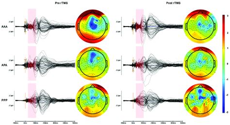 group average tep topography butterfly plot of eeg traces and