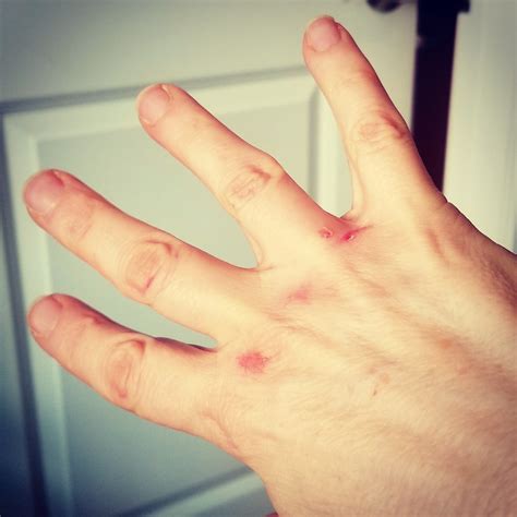 Bloody Knuckles Quotes