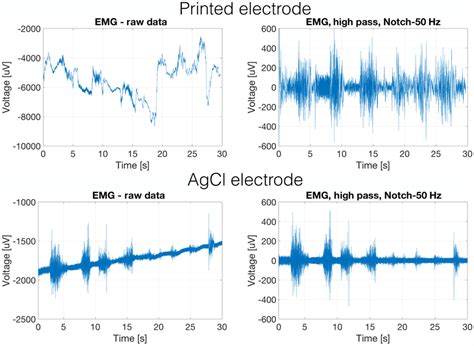 Comparison Of Semg Signals Acquired With Printed And Regular Agcl
