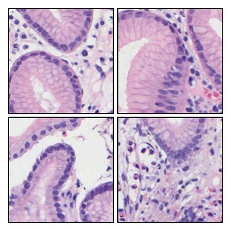 “nonprofessionally” Annotated Tissue Wise Datasets A Background B