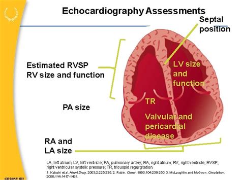 Echocardiography In Right Ventricular Failure And Pulmonary Hypertension