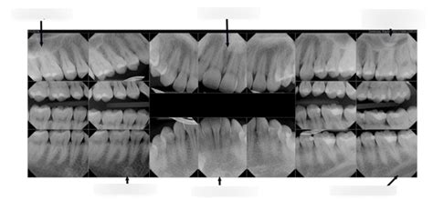 Dental Landmarks In Fmx Diagram Quizlet