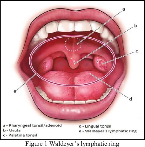 Tonsils And Adenoids Diagram