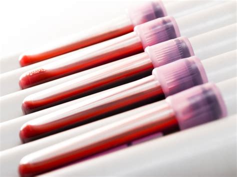 Alpha Fetoprotein Test Purpose Procedure And Results