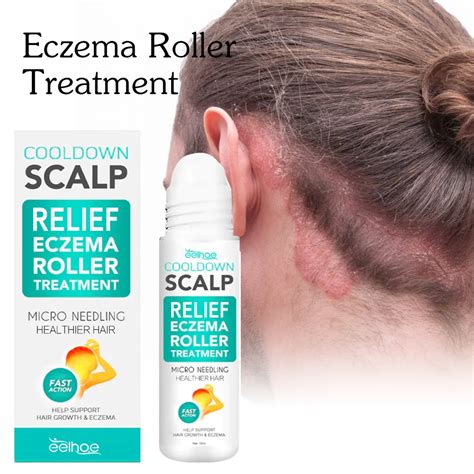 머리 여드름 가려움증 두피 백선 피부 문제 지루성 크림 복구 이끼 스킨 케어 롤러볼 티몬