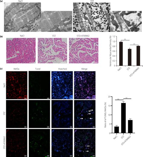 Hyperglycemia Induced Muscular Disarray Myofibril Loss Vacuolization
