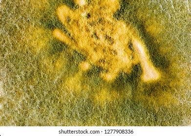 137 Imágenes De Trichoderma Imágenes Fotos Y Vectores De Stock