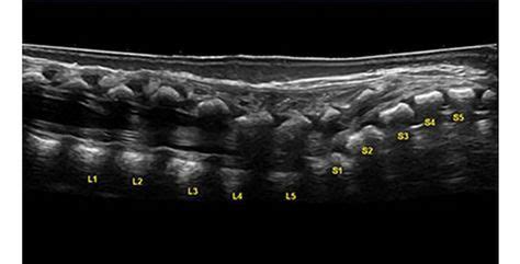 Pin On Ultrasound