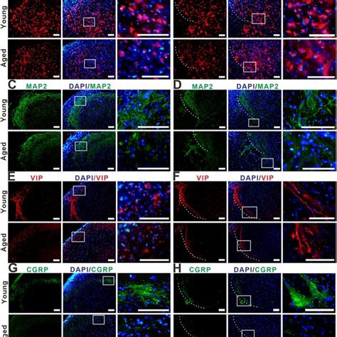 The Positivity Of Neun A B Map2 C D Vip E F And Cgrp Download Scientific