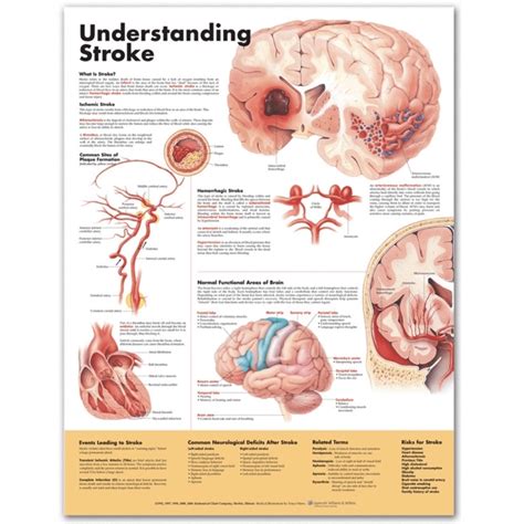 Education Anatomical Charts Understanding Stroke Anatomical Chart