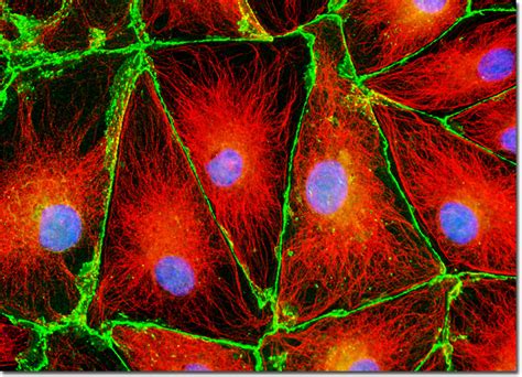 Molecular Expressions Microscopy Primer Specialized Microscopy