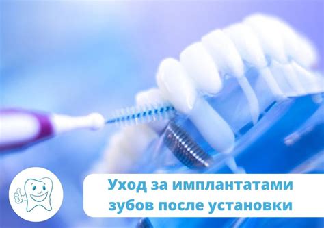 Как ухаживать за имплантами зубов после процедуры в Подольске ...