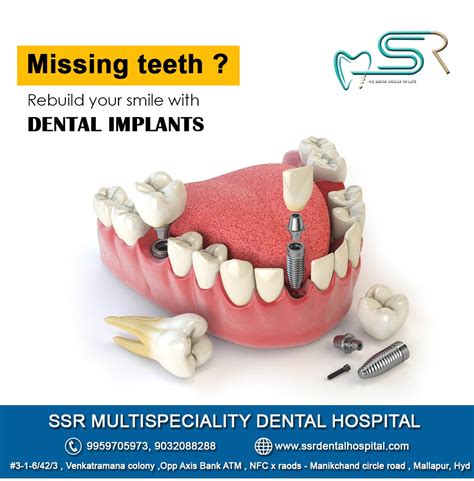 Dental Gov Reimbursement Scheme Best Dental Hospital In Mallapur
