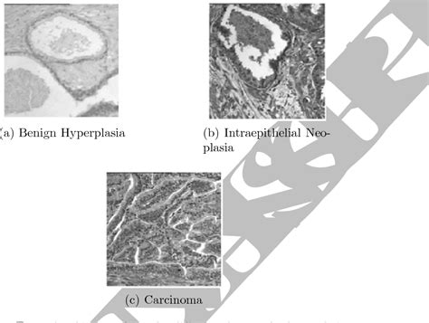 Figure 1 From Automatic Classification Of Colorectal And Prostatic