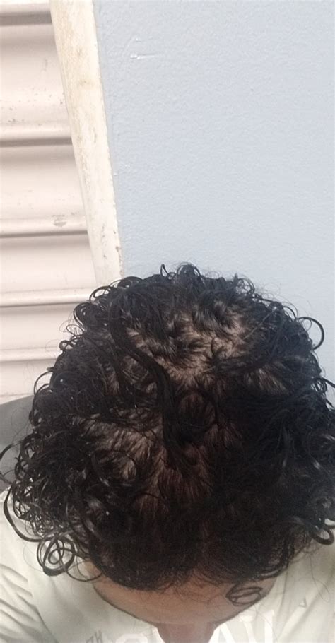 Is It Normal To See This Much Scalp 18m R Curlyhair