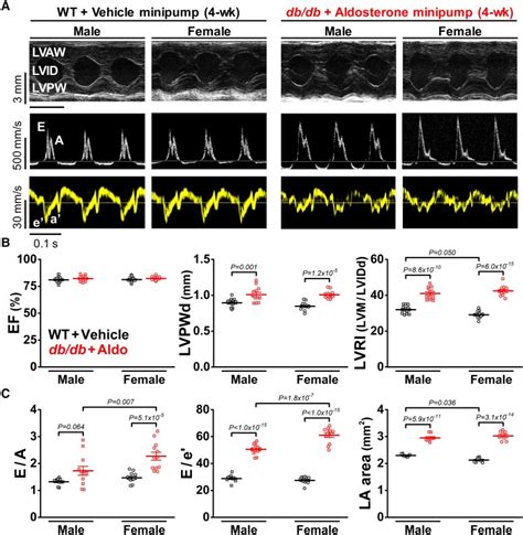 Differential Sex Dependent Susceptibility To Diastolic Dysfunction And
