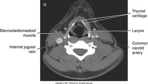 LAB Quiz Flashcards Quizlet