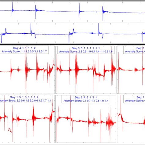 Displaying Several Examples Of Normal And Anomalous Sequences Of Signal