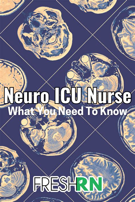 Neuro Icu Nurse What You Need To Know Artofit