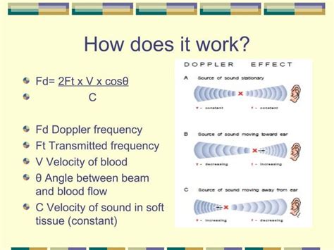Pre Operative Non Invasive Cardiac Output Measurement Ppt