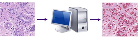 Automated Nuclei Segmentation In Hande Breast Cancer Samples Download Scientific Diagram