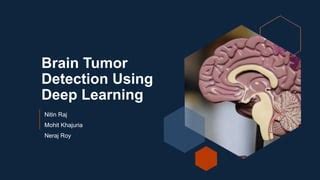 Brain Tumor Detection Using Deep Learning Ppt New Made Pptx
