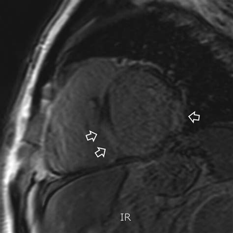 Case 2 Cardiac Magnetic Resonance Imaging Download Scientific Diagram