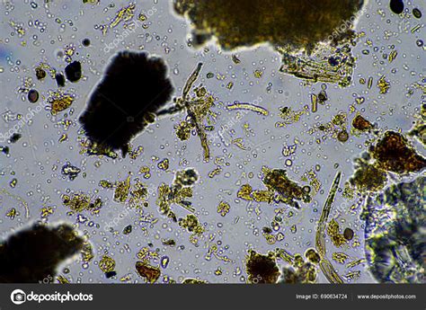 Human Parasite Gut Intestinal Infection Disease Microorganism Infection