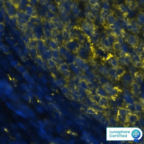 Human Hla Dr Antibody Mab11555 100 Randd Systems