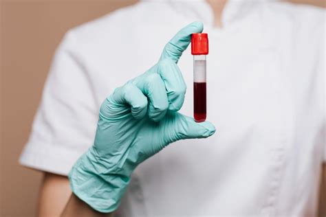Normal Hemoglobin Level In Female