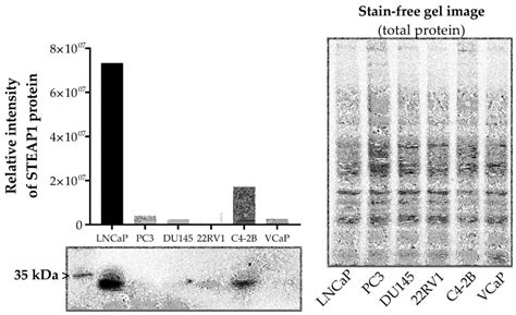 Steap1 Knockdown Decreases The Sensitivity Of Prostate Cancer Cells To