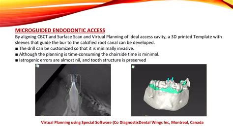 Minimal Invasive Endodontics Pptx