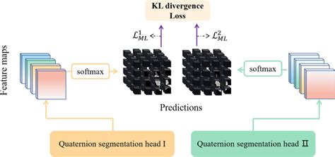 an illustration of voxel wise lesion knowledge mutual learning