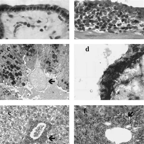 Histologic Features Of C Parvum Infection In Cd40l Knockout Mice A