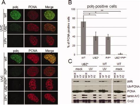 Both UBZ and PIP motifs are required for efficient localization of polη Download Scientific