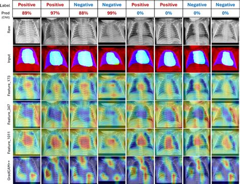 Examples Of Feature Maps Of The Last Convolutional Layer Before The
