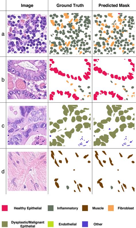 Multi Class Segmentation Results On Consep Dataset First Column Download Scientific Diagram